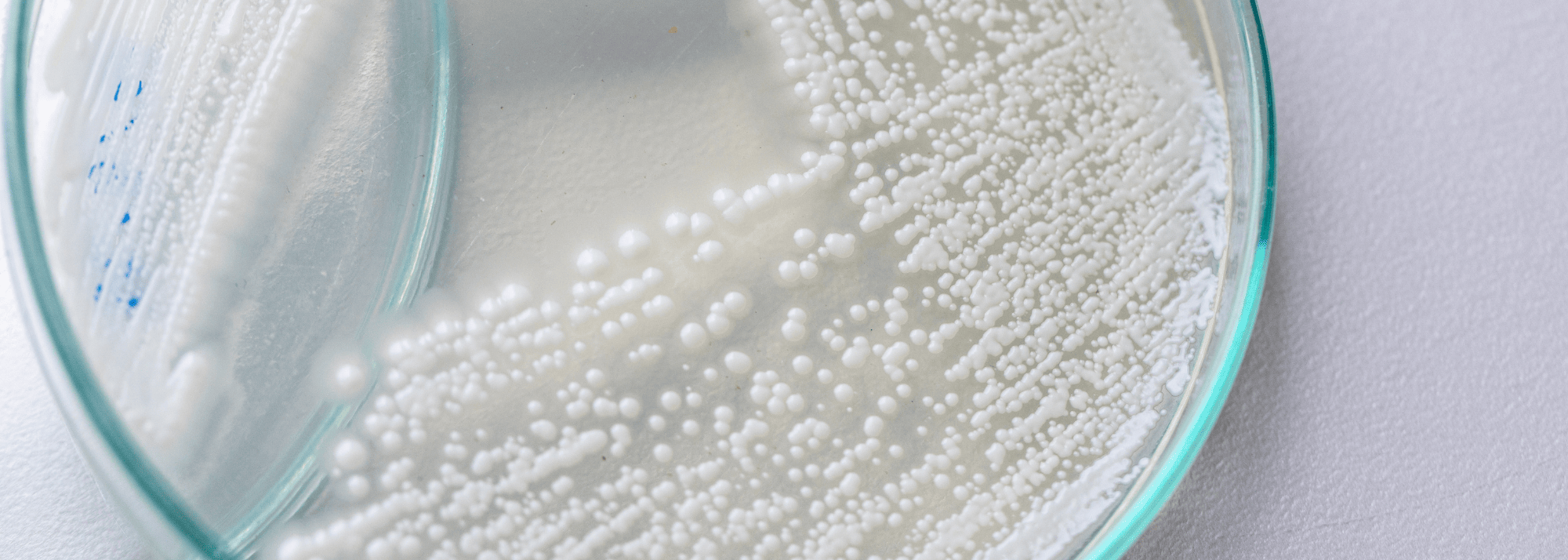 Pichia pastoris - Case Study - sbi