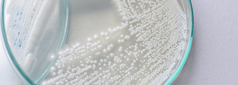 Pichia pastoris - Case Study - sbi