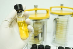 Microorganism Spotlight - Anaerobic Organisms