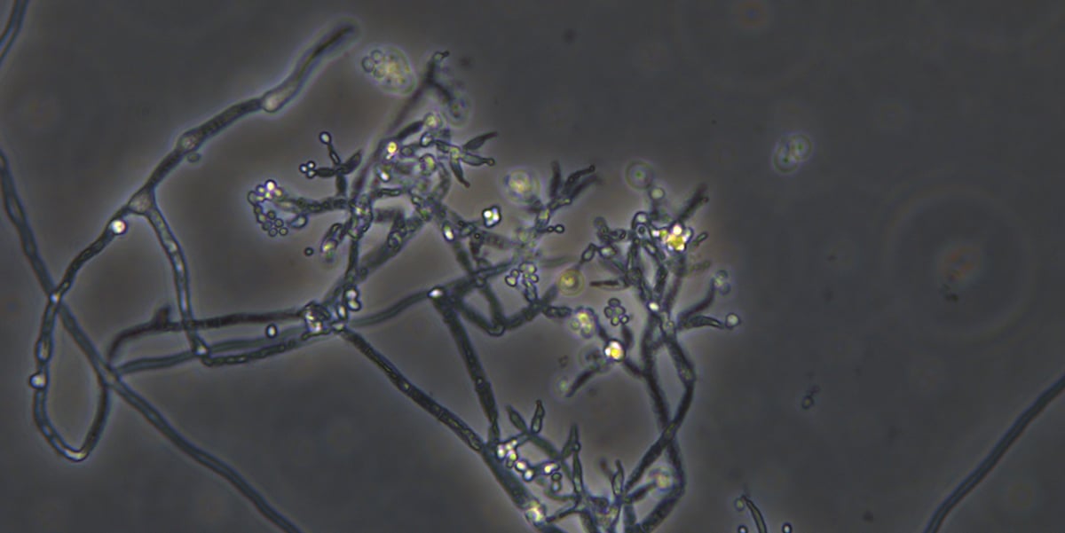 Microorganism Spotlight - Filamentous Organisms