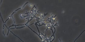 Microorganism Spotlight - Filamentous Organisms