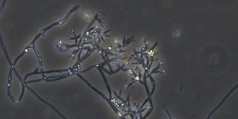 Microorganism Spotlight - Filamentous Organisms