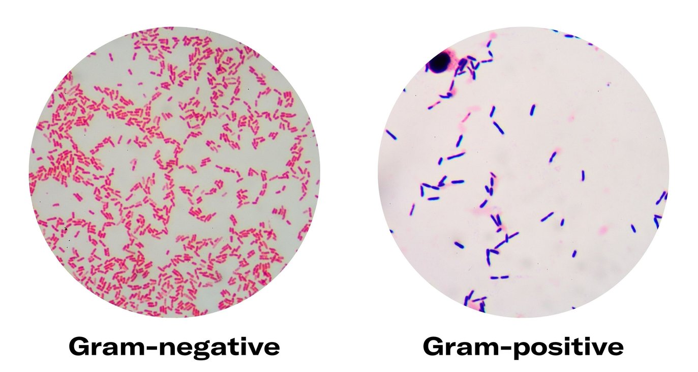 Microorganism Spotlight - Bacteria